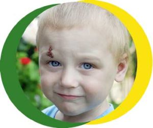 Head Injury - NHS Nottingham and Nottinghamshire ICB